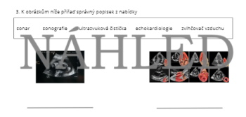 Ultrazvuk a infrazvuk | Učitelnice